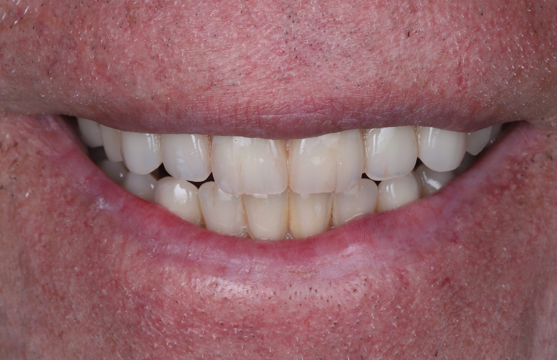 Harris Dental Boutique Your Bundaberg and Bargara Dentist