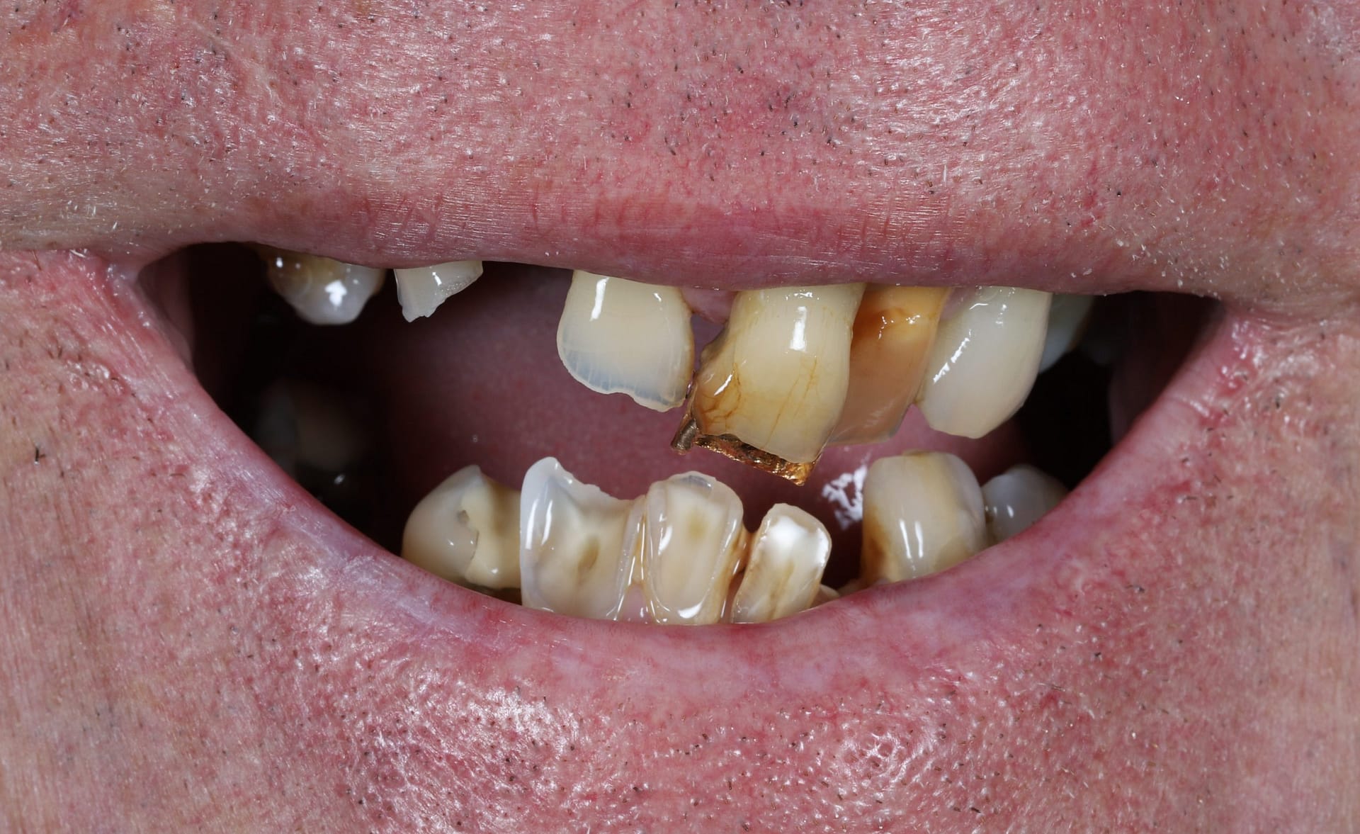 Harris Dental Boutique Your Bundaberg and Bargara Dentist