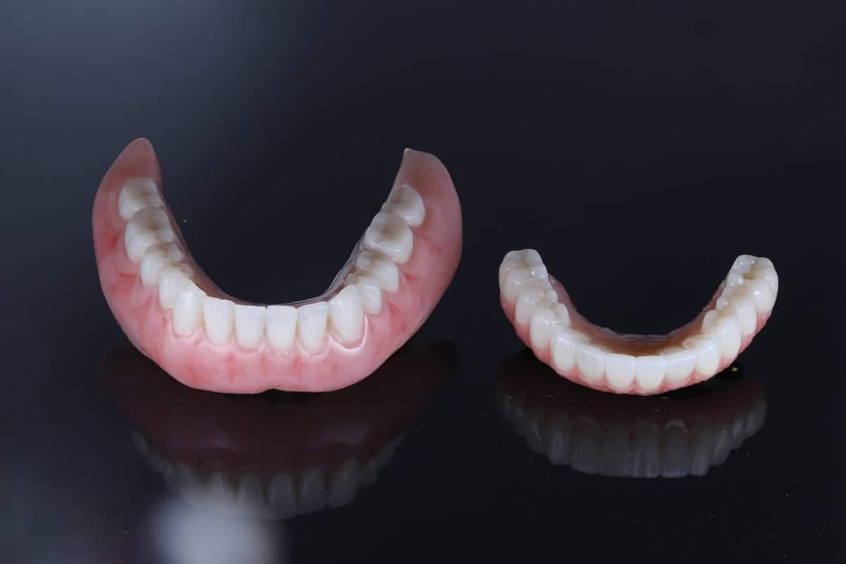 What is Bridge on Implants / All-on-4®? - Harris Dental Boutique